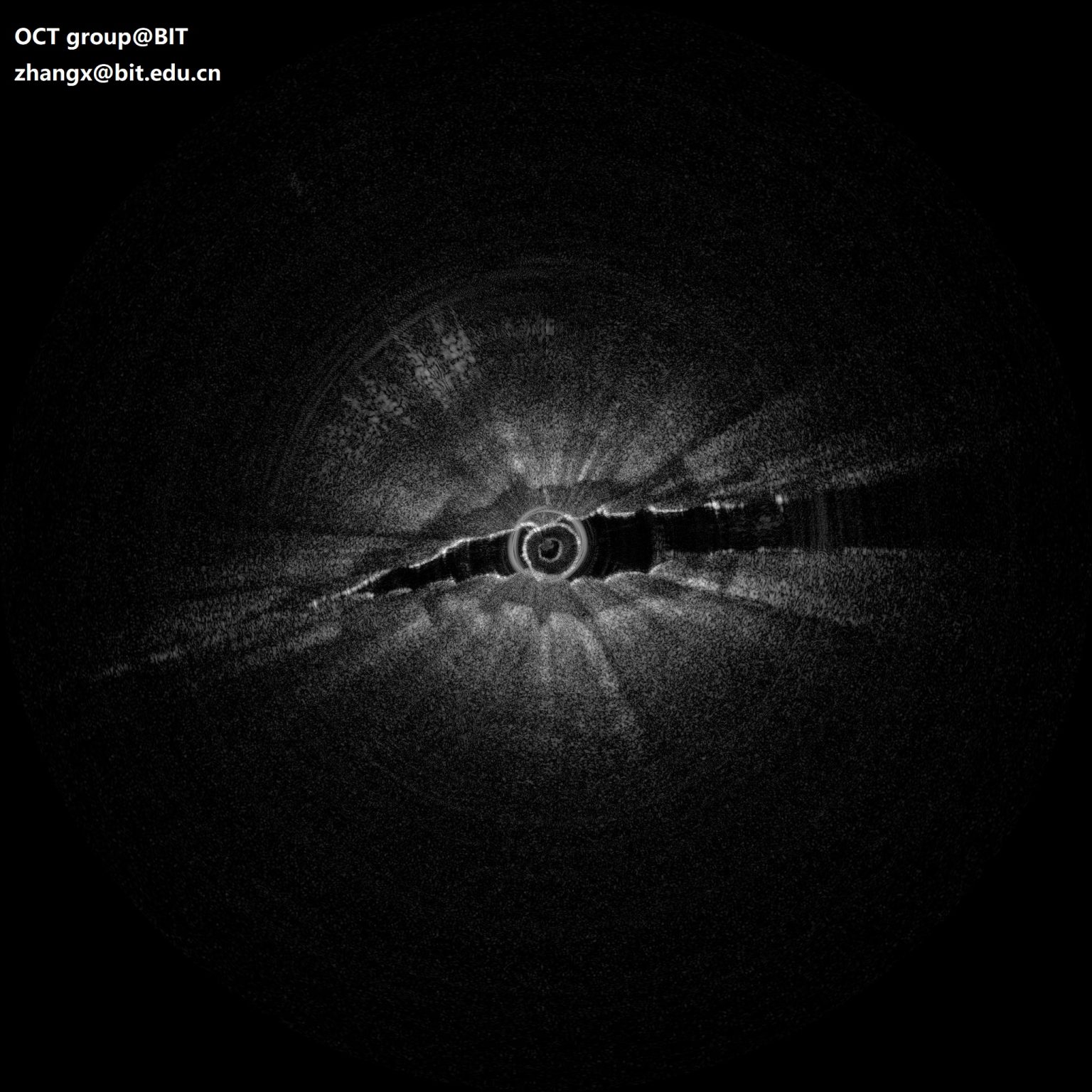 血管光学相干断层成像(OCT) – Prof. Zhang's website